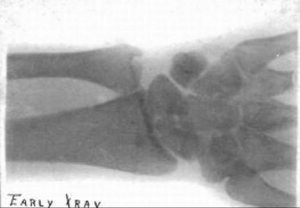 Stolen History: America’s First X-Ray Was Made Illegally | Gadgets ...